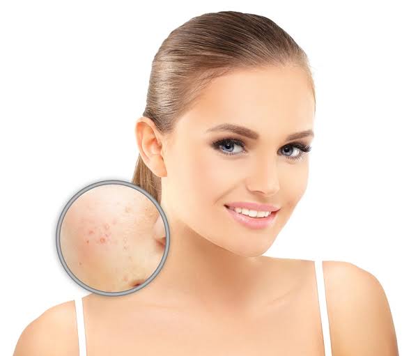 How to Reduce Skin Pigmentation? - Topics Reader